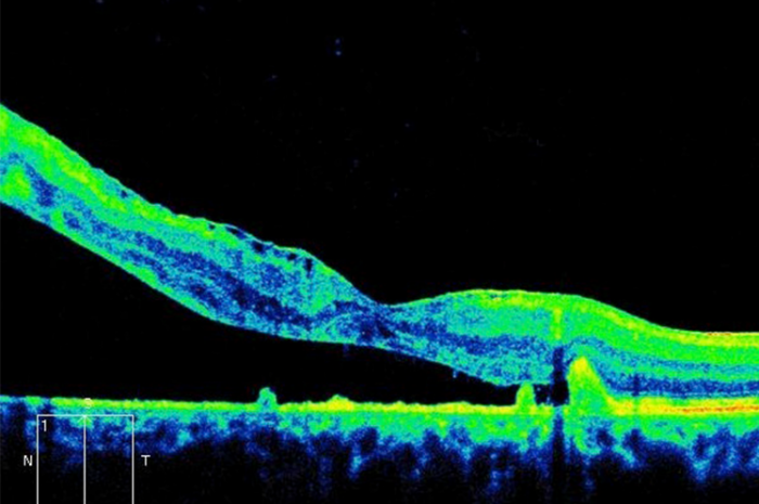 Diagnostic Equipment | Best Optometrist in Toronto, CA